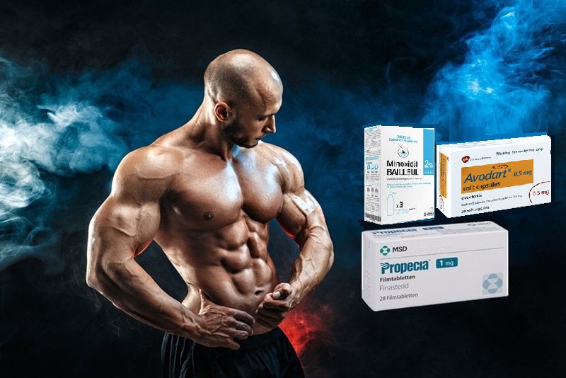 Steroidi Anabolizzanti Androgeni e perdita dei capelli (alopecia ...